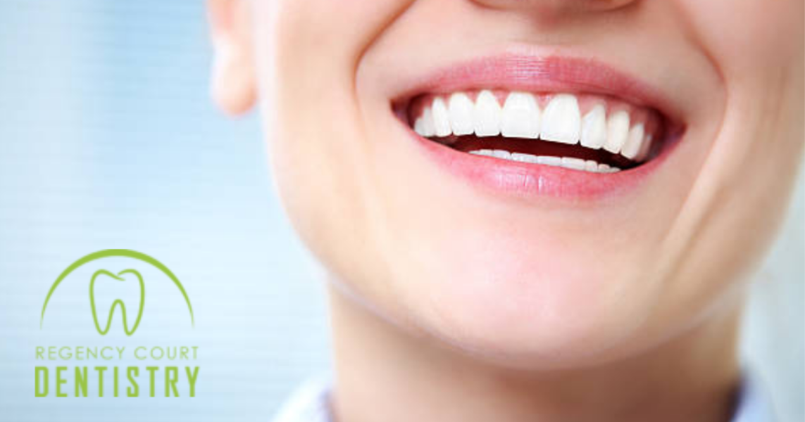 4 Most Popular Smiles Makeover Procedures